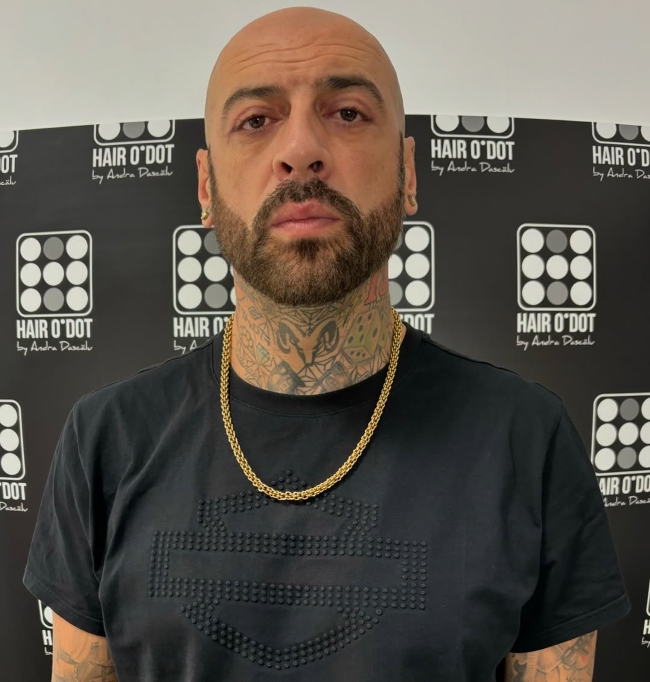 CRBL a prins "gustul" intervențiilor estetice. A vizitat din nou ...